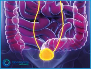 Lesiones Actínicas causadas por Radioterapia
